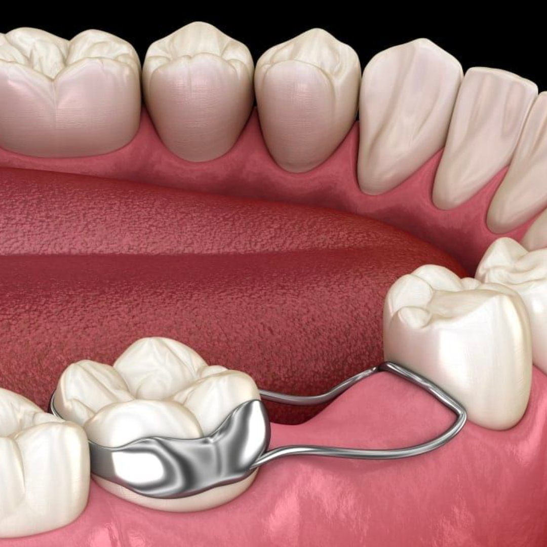 Dental Services - Downtown Sleep Dentistry